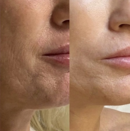 Vivace - Revitalise Skincare Clinic Bath Trowbridge