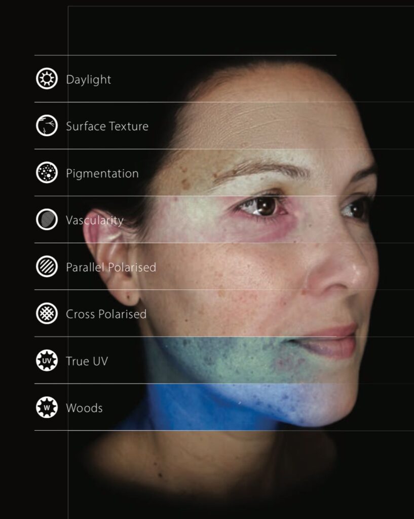 Consultation - Revitalise Skincare Clinic Bath Trowbridge